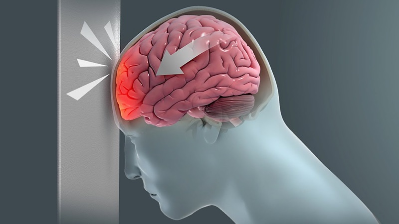Four Habits You Might Not Realize Are Harming Your Brain
